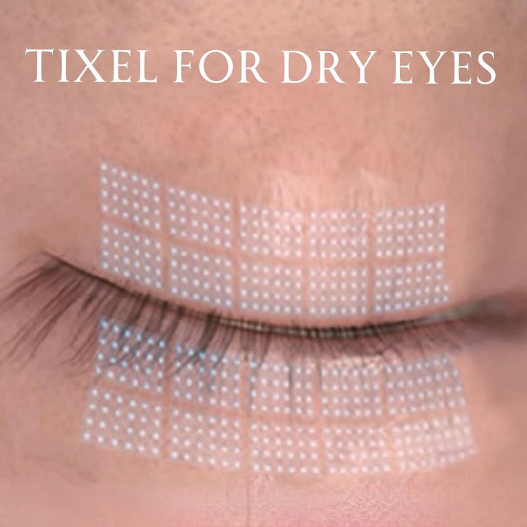 Tixel Eye Lift | Rejuvience Med Spa Scottsdale – Rejuvience Med Spa